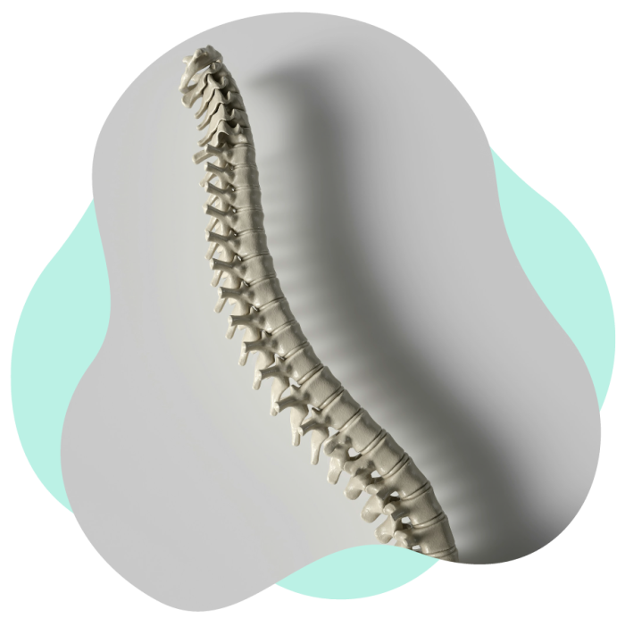 Adolescent Idiopathic Scoliosis - SSR