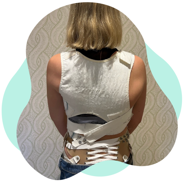 Scoliosis Bracing - SSR